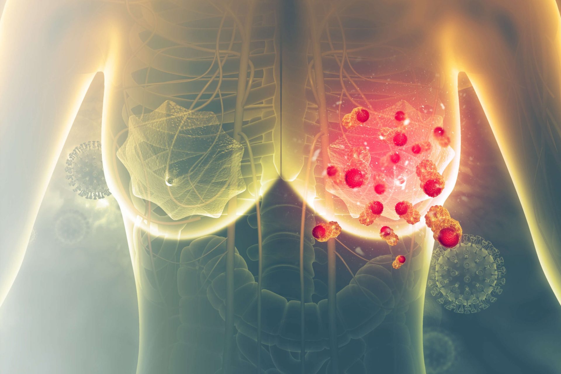Breast Cancer - Packard Law Firm